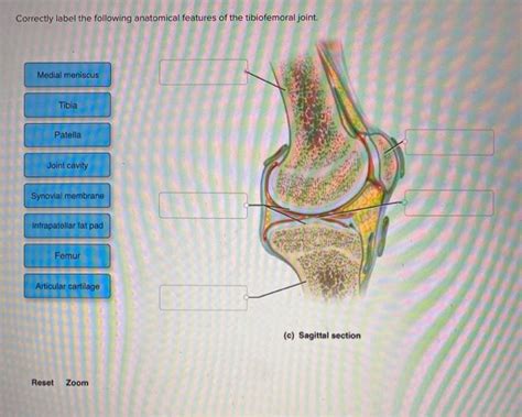 Solved Correctly Label The Following Anatomical Features Of Chegg