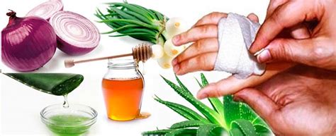buenísimos remedios caseros muy fáciles de preparar para toda quemadura