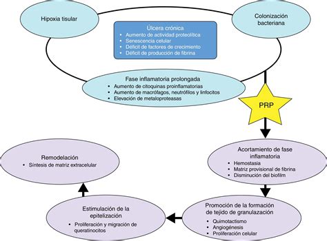 Utilidad del plasma rico en plaquetas en el tratamiento de las úlceras