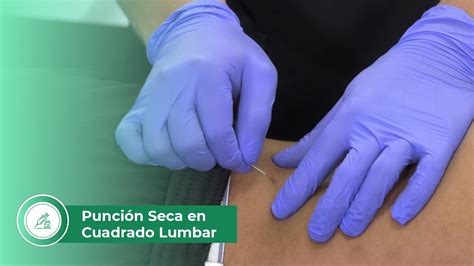 Punción seca en cuadrado lumbar YouTube