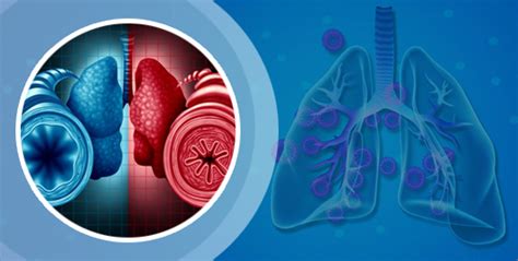 Cmc Vellore Respiratory Medicine Dept
