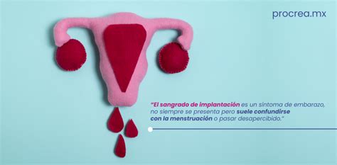 Sangrado de implantación Cómo identificarlo Procrea