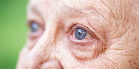 Degeneração Macular Relacionada à Idade o que é importante saber
