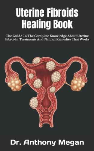 Uterine Fibroids Healing Book The Guide To The Complete Knowledge