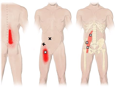 The Psoas Muscle Yoga Anatomy