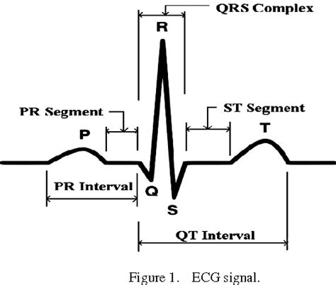 figure 1 from discrete wavelet transform based algorithm for recognition of qrs complexes