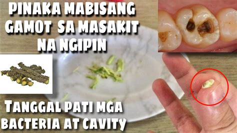 MABISANG GAMOT SA SAKIT NG NGIPIN SUPER EFFECTIVE AND SAFE Jery