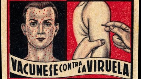 La Viruela En La Historia Podcast Cortando Por Lo Sano IEFS
