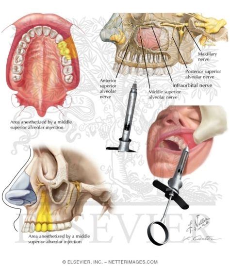 Mittlerer Oberer Alveolar