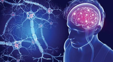 Qu est ce que la sclérose en plaques Symptômes Diagnostic et