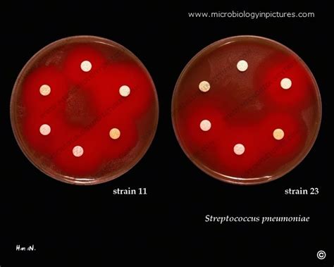 The Disk Diffusion Susceptibility Tests With Pneumococci Kirby Bauer