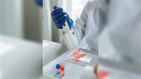 The Role Of A Longevity Gene Explored In Commonwealth Union