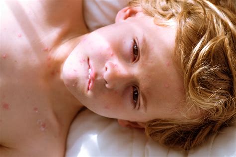 Santé infantile pédiatrie Pharmalog
