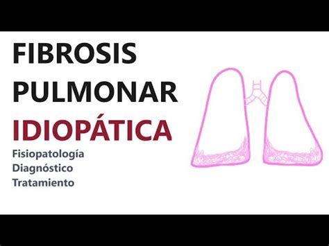 Neumología Fibrosis pulmonar idiopática fisiopatología diagnóstico