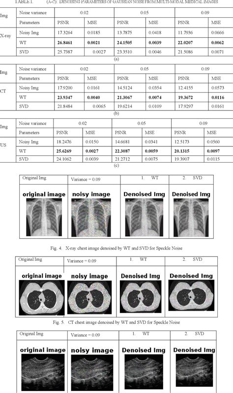 figure 4 from efficient denoising of multi modal medical image using wavelet transform and