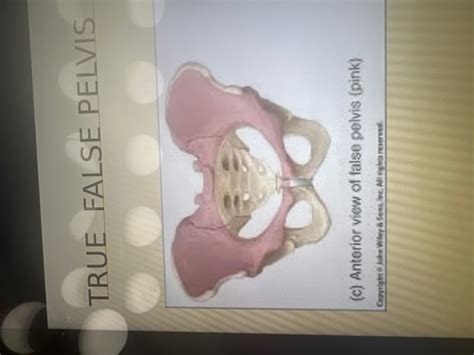 Normal Anatomy Of The Female Pelvis Flashcards Quizlet