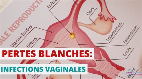 Pertes Blanches Quand Faut Il Suspecter Une Infection Youtube