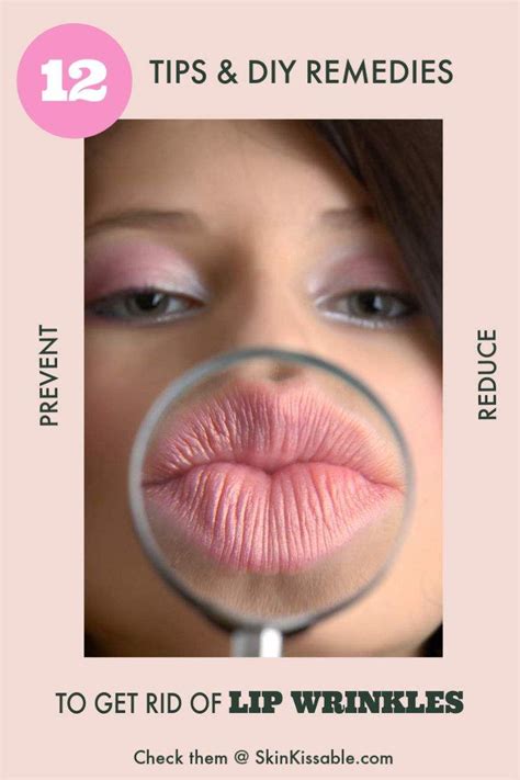 How To Get Rid Of Vertical Lip Lines With The Best Treatments And DIY