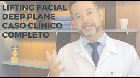 Lifting Facial Deep Plane Ou Plano Profundo Em Paciente De 50 Anos