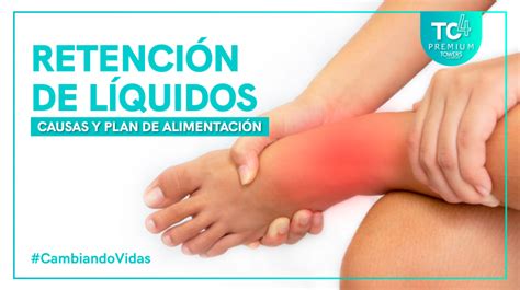 Retenci N De L Quidos Causas Y Plan De Alimentaci N Tc Premium