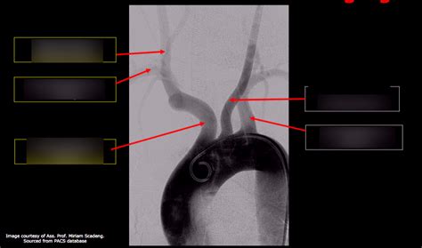 Cardio Radiology Diagram Quizlet