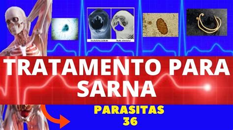 TRATAMENTO PARA SARNA HUMANA ESCABIOSE SARCOPTES SCABIEI HOMINIS