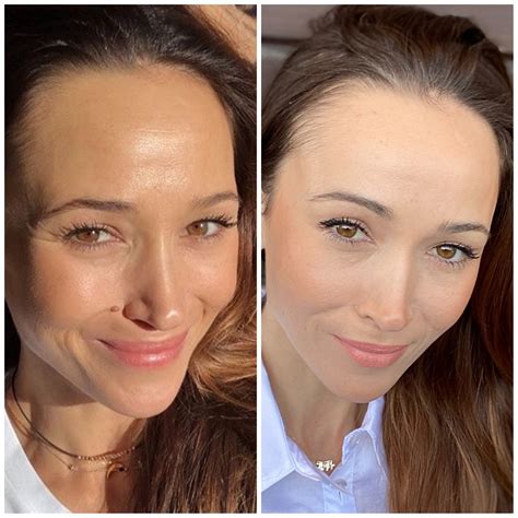 Chirurgiczne Usuwanie Znamion Mea Clinic
