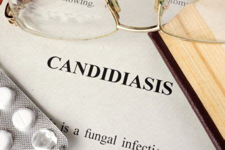 Qué es la candidiasis síntomas causas y tratamiento BlogMedicina