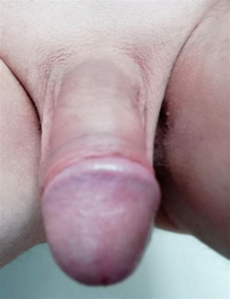 Me Dick Pitsi