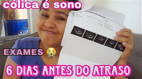COMO DESCOBRIR A GRAVIDEZ 6 DIAS ANTES DO ATRASO MESTRUAL SINTOMAS