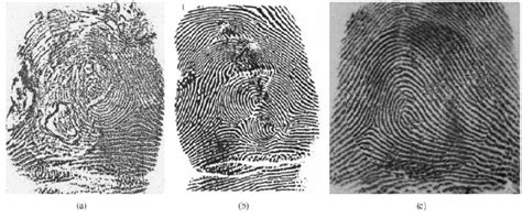 three types of altered fingerprints a obliterated fingerprint e g download scientific