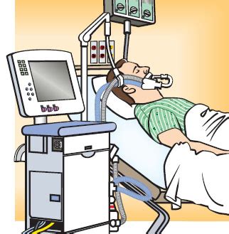 La ventilación mecánica un tratamiento de soporte vital Siamed SA