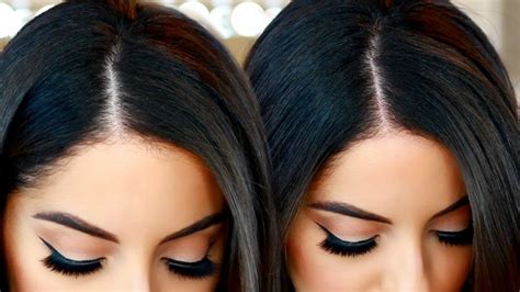 Gemidos Rebaja Inminente Alopecia Coronilla Mujer Una Noche Lima Primero