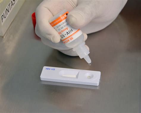 INMUNOLOGIA LAB CLINICO 4B PRUEBAS INMUNOLOGICAS