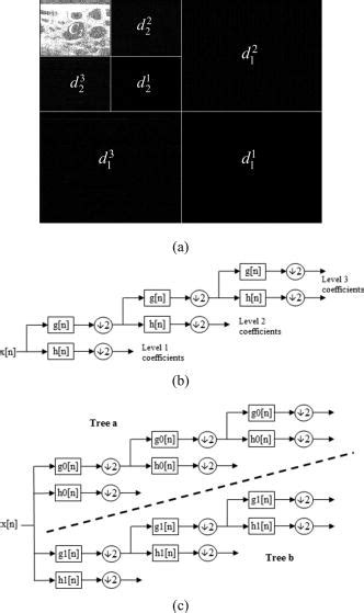 denoising during optical coherence tomography of the prostate nerves via wavelet shrinkage using