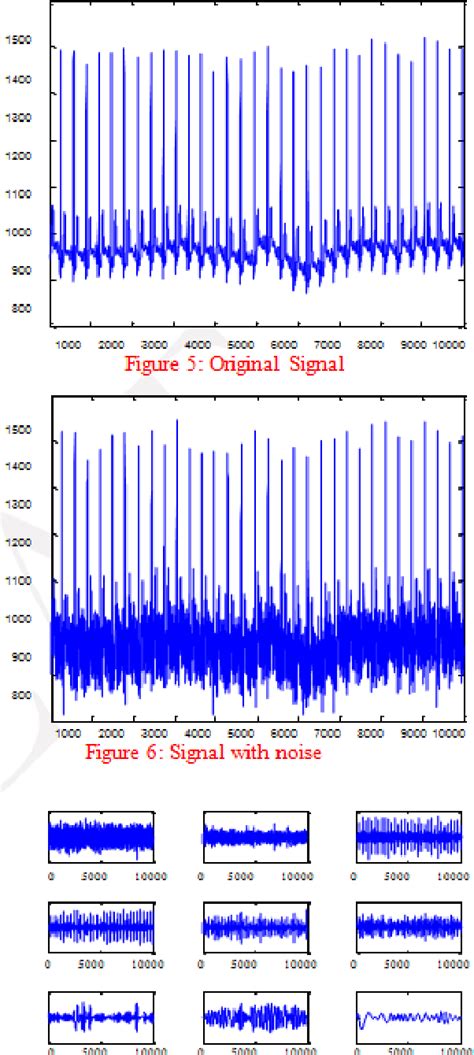 figure 1 from denoising of ecg signal using soft thresholding and empirical mode decomposition