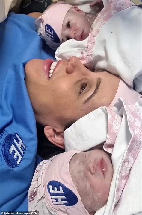 لحظة نادرة بشكل لا يصدق ولادة طفلة داخل كيسها الأمنيوسي في حدث واحد من