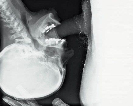 X Ray See Through Sex Cumception