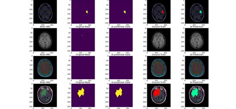 brain tumor segmentation and classification using resunet learnmachinelearning
