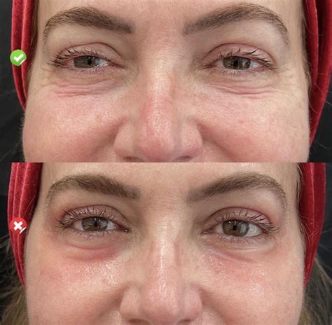 Line Skin Fenol Dermatho Clin Clínica de Estética Avançada Facial