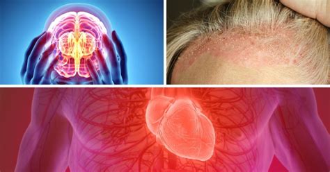 7 órganos del cuerpo son afectados por el estrés crónico Salud180