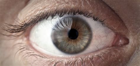 Ptosis Palpebral Causas Síntomas y Tratamiento Clínica Medina