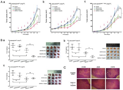 Effect Of Gefitinib And Cisplatin Combination On NSCLC Xenografts