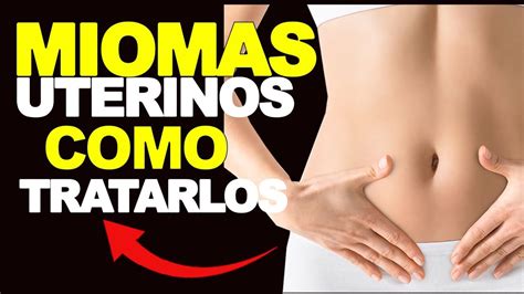 Miomas Uterinos Sintomas Y Tratamiento Natural Para Combatirlos Causas