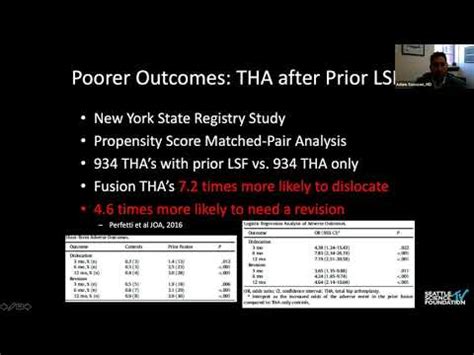 Order Of Operations Total Hip Arthroplasty And Spinal Fusion Adam A