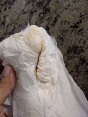 corrimento marrom após a Menstruação ir embora BabyCenter