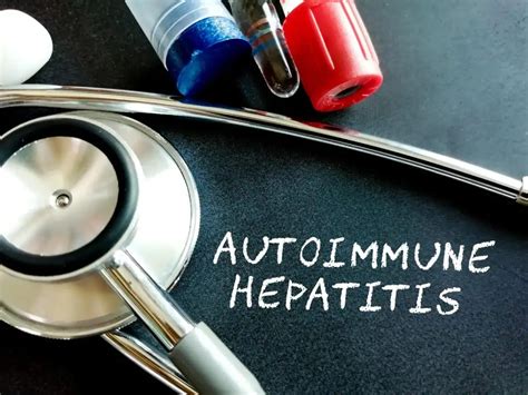 Autoimuni hepatitis uzrok simptomi liječenje Arz hr