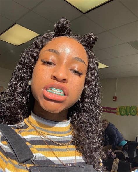 Cute Braces Colors For Dark Skin Warehouse Of Ideas