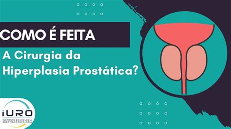 Como é feita a cirurgia da hiperplasia prostática YouTube