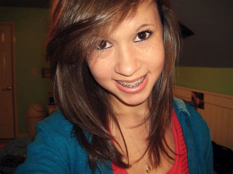 Delightful Braces Smiles Flickr DaftSex HD